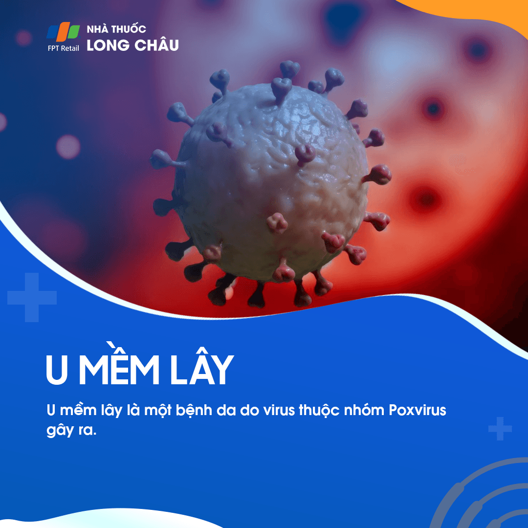 U mềm lây: Triệu chứng, nguyên nhân và cách điều trị