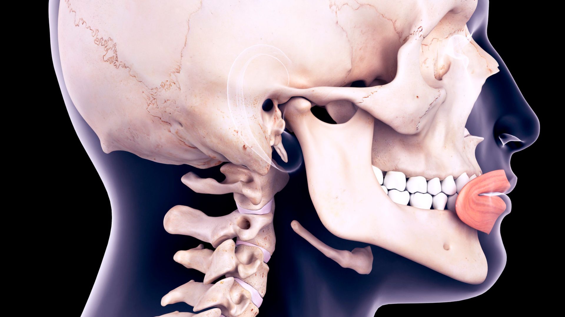 Bệnh Cancrum oris nguy hiểm như thế nào? Triệu chứng bệnh?