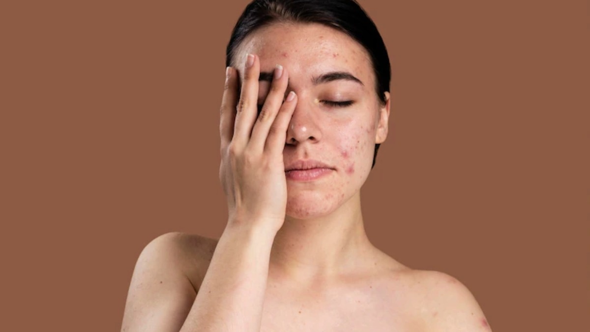 Cảm giác có con gì bò trên mặt có phải dấu hiệu của bệnh lý? - Nhà ...