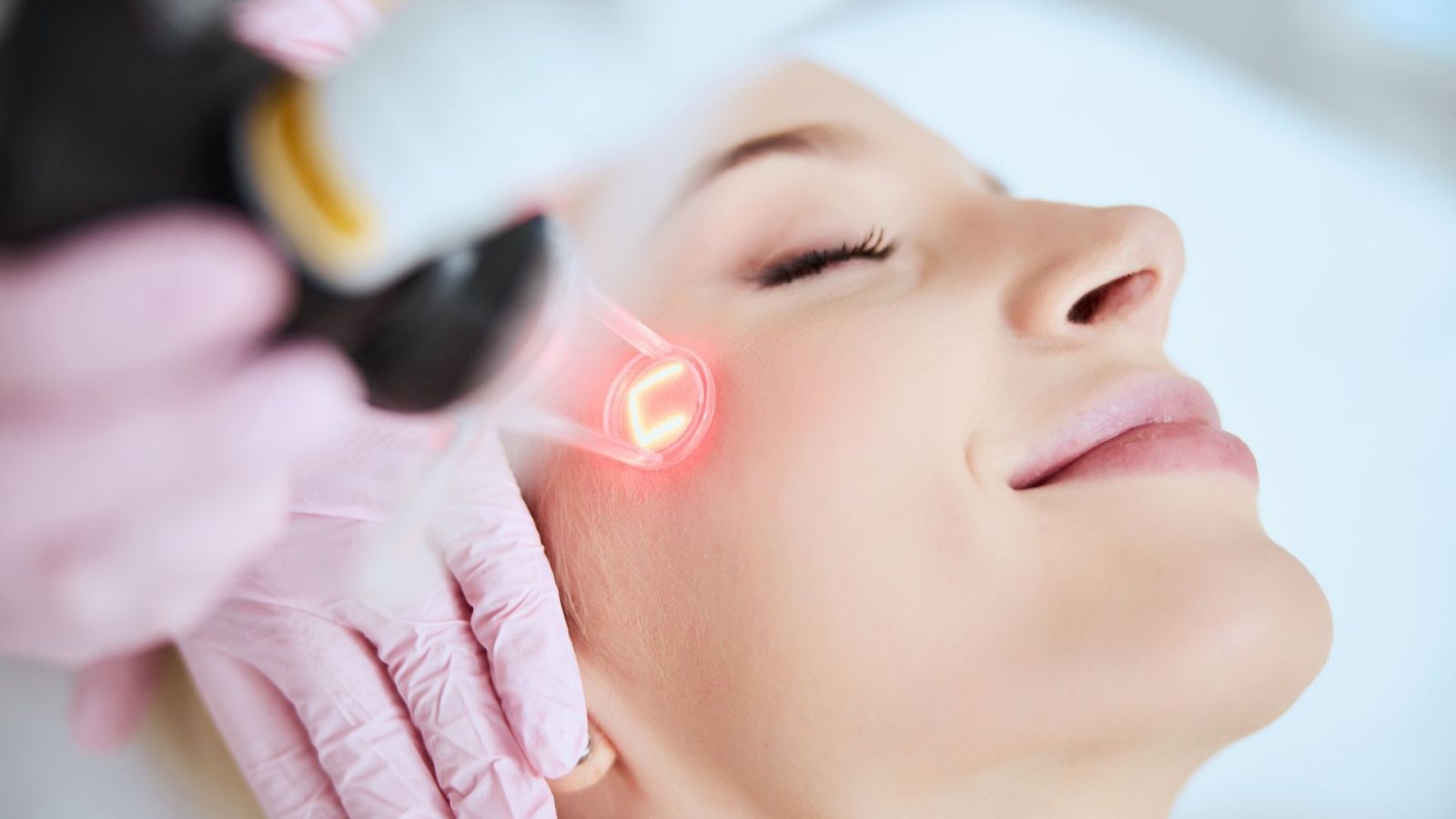 Công dụng của laser tái tạo da và lưu ý sau khi sử dụng