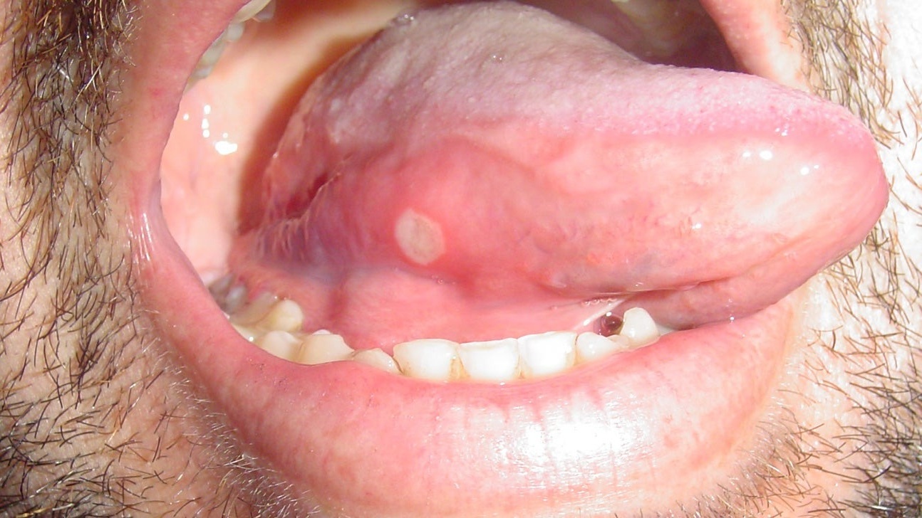 Papillae là gì? Cách hoạt động của một Papillae như thế nào?