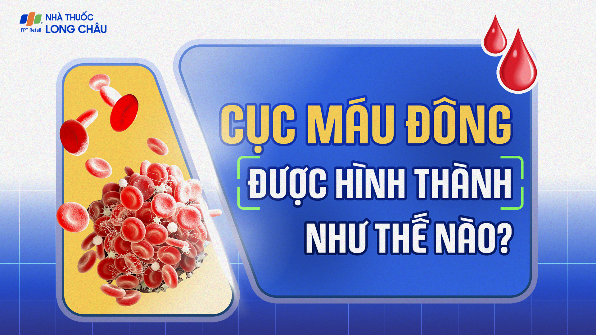 [Infographic] Cục máu đông được hình thành như thế nào? - Nhà thuốc FPT ...