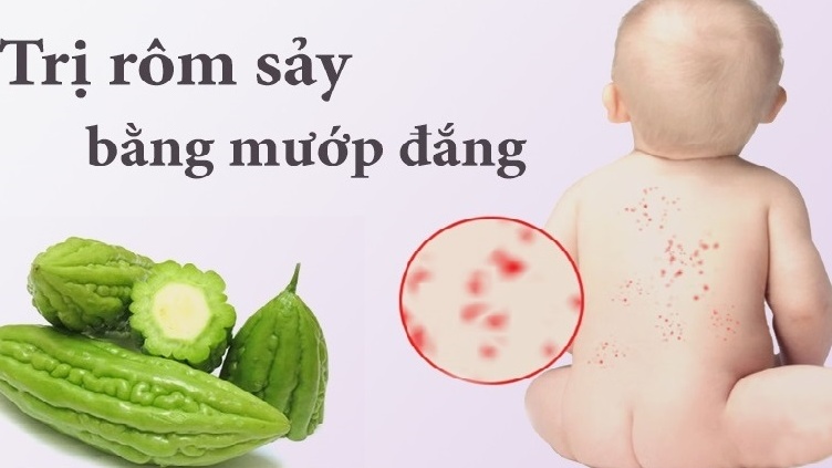 Cách trị rôm sảy cho trẻ bằng mướp đắng tại nhà cực kỳ đơn giản