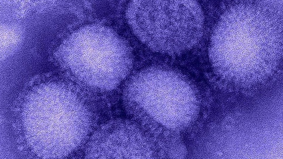 Virus cúm D: Đặc điểm cấu tạo và biện pháp để phòng tránh